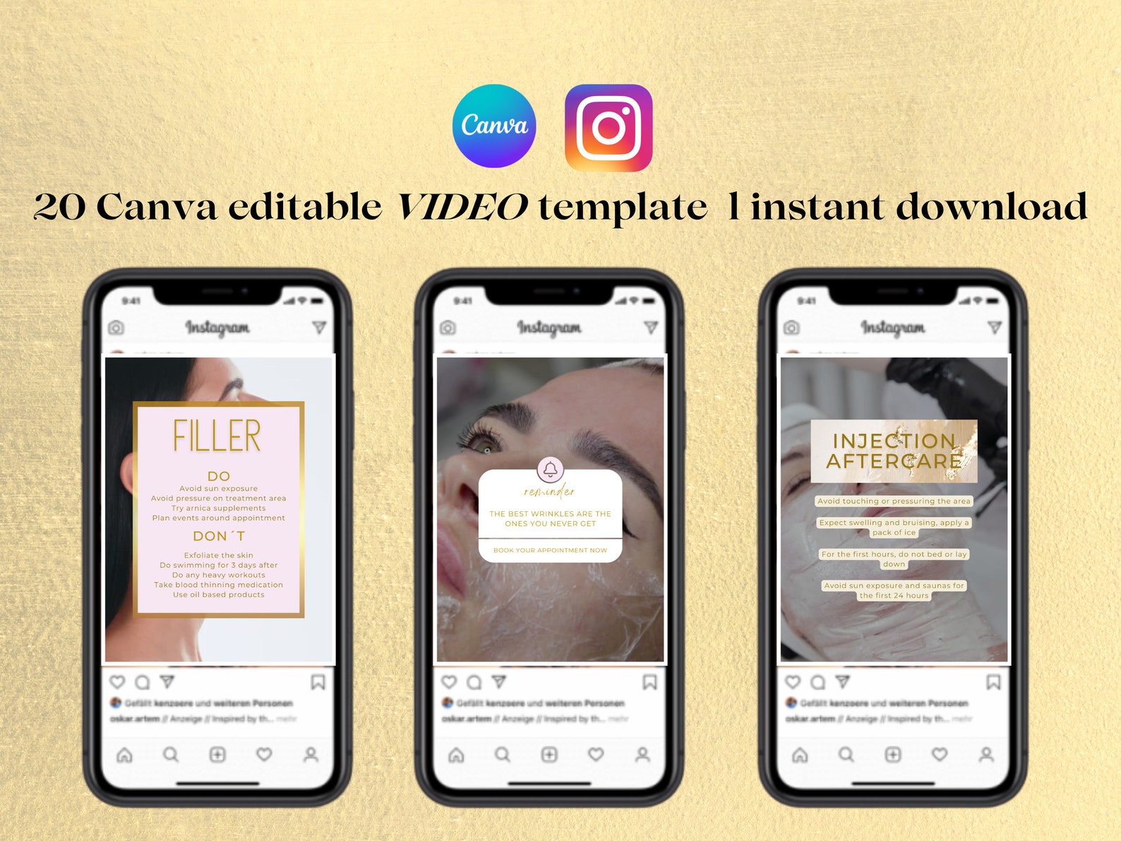 20 Editable Instagram Reel Anti Wrinkle and Filler Post Templates ...