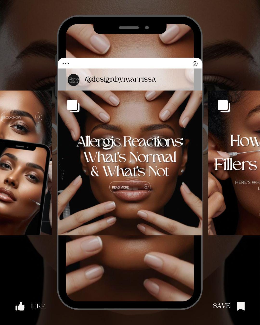 Botox & Filler Instagram Post, Lip Filler Posts, Injector Canva ...