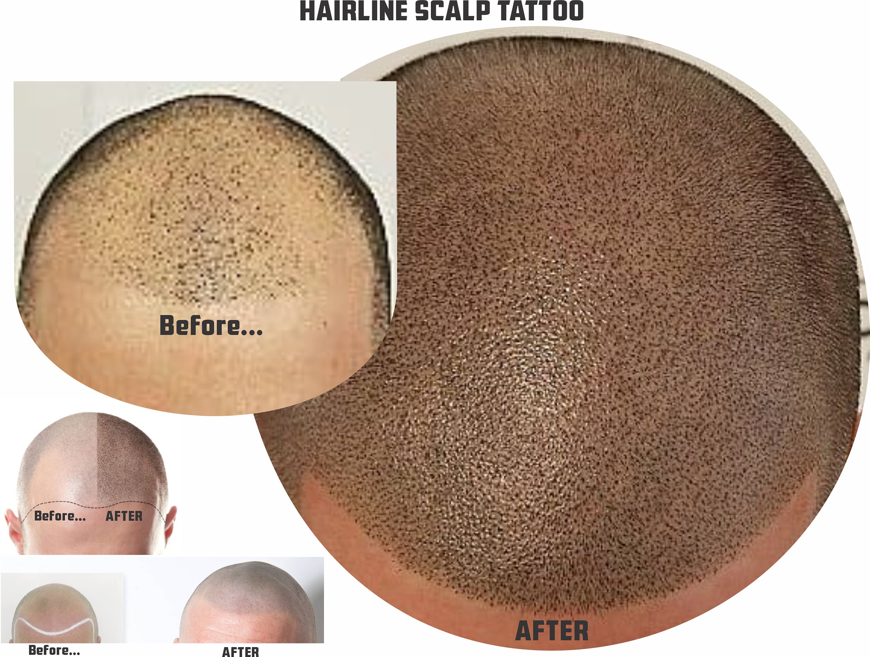 TEMPORARY TATTOO SCALP Hairline (digital Download Only) - Etsy