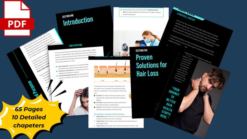 Hair Loss Reversal Blueprint PDF, Hair Care, Hair Health, PRP Treatment ...