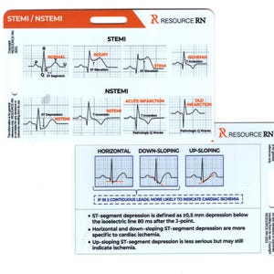 EKG Rhythm, STEMI, NSTEMI Analysis Reference Cards—6-card Set for Rapid Interpretation— Both ...