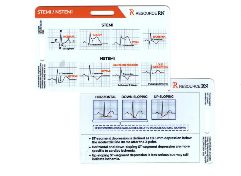 EKG Rhythm Analysis Nurse Badge Cards: STEMI, NSTEMI - 6-card Set - Etsy