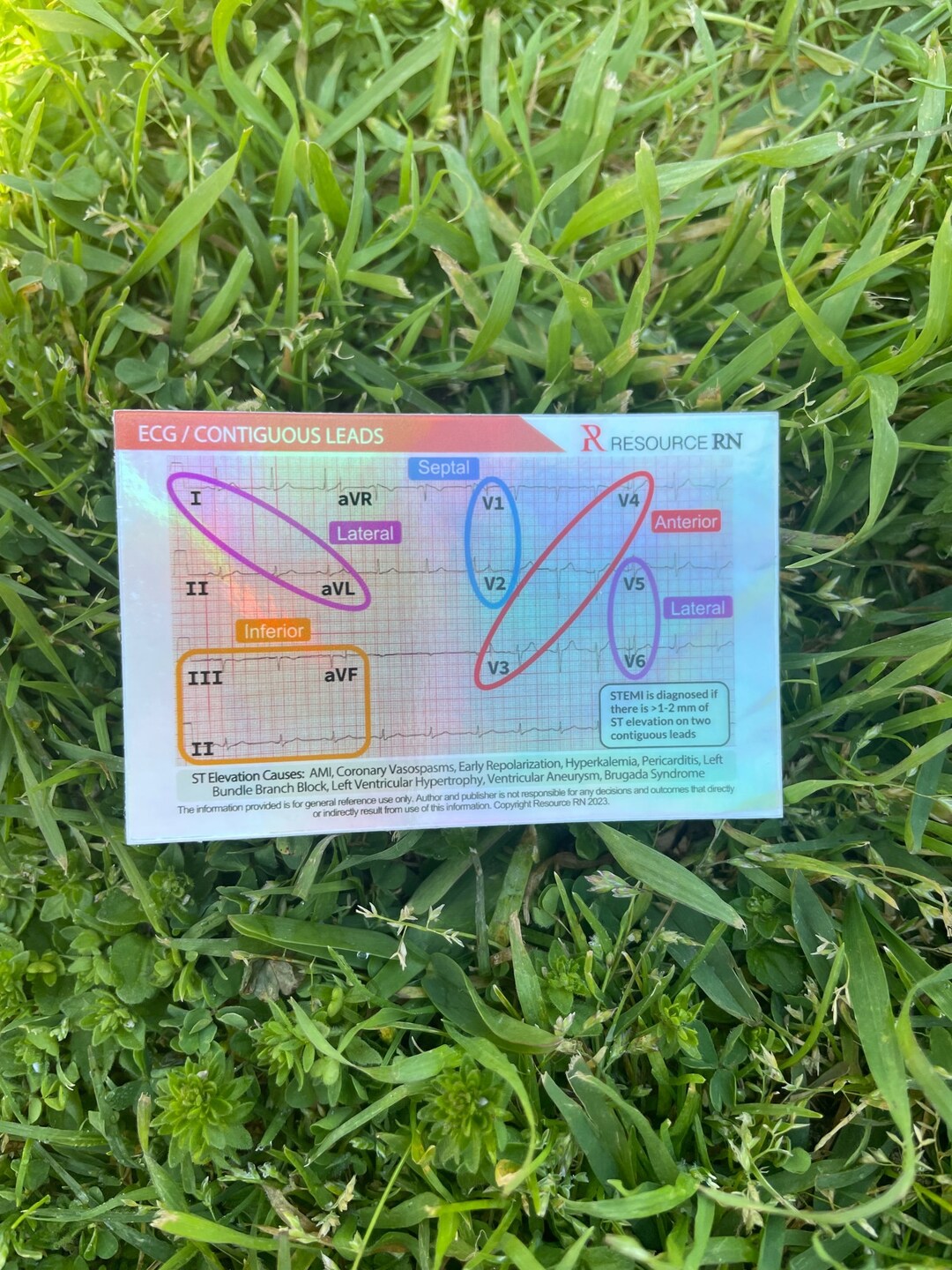 Holographic Sticker EKG STEMI Reference Tool Badge Card - Etsy