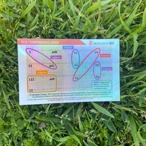 Holographic Sticker EKG STEMI Reference Tool Badge Card - Etsy