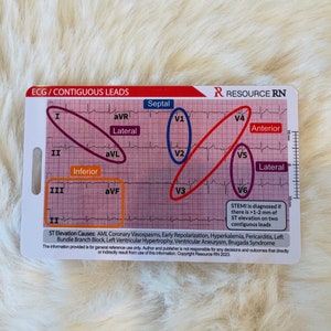 EKG STEMI Reference Tool VERTICAL Badge Card Pocket Guide - Etsy