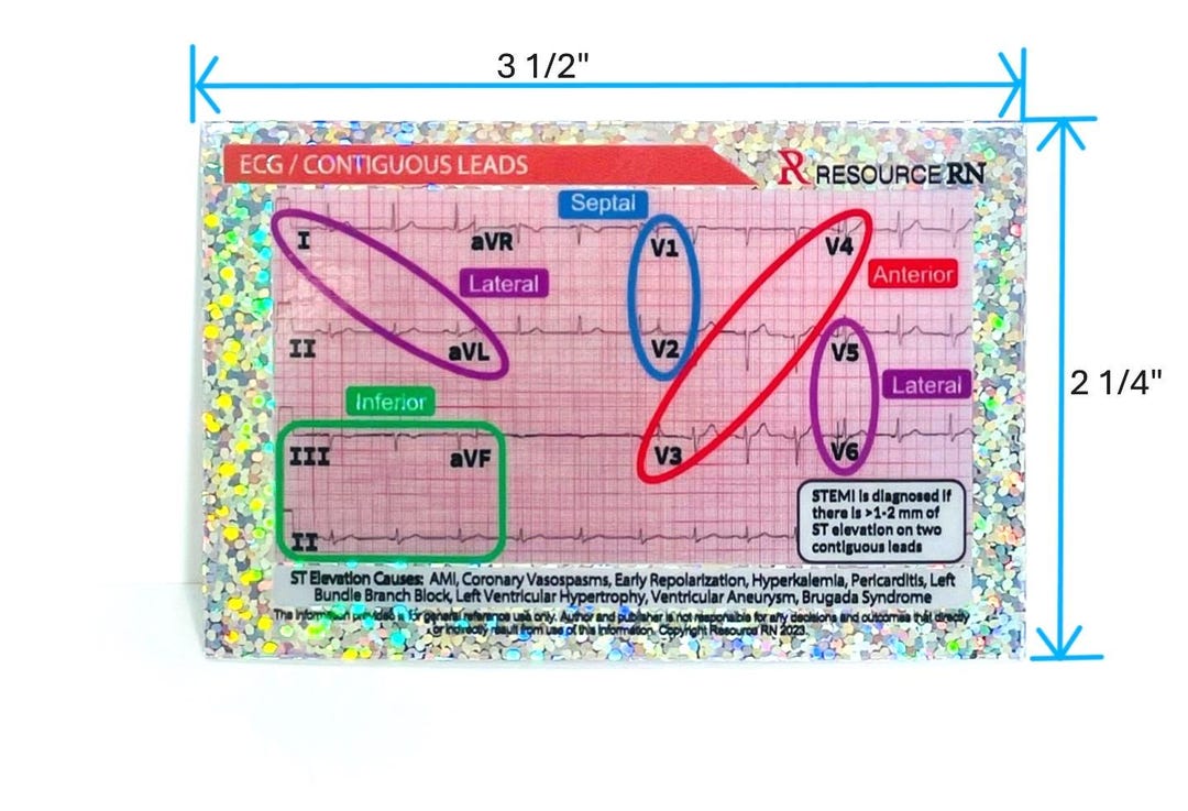 Glitter Sticker - EKG STEMI Reference Tool RN Card - Etsy