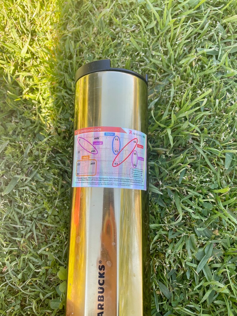 Holographic Sticker EKG STEMI Reference Tool Badge Card - Etsy