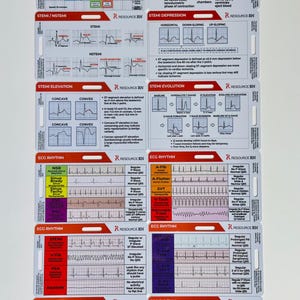EKG Rhythm, STEMI, NSTEMI Analysis Reference Cards—6-card Set for Rapid ...
