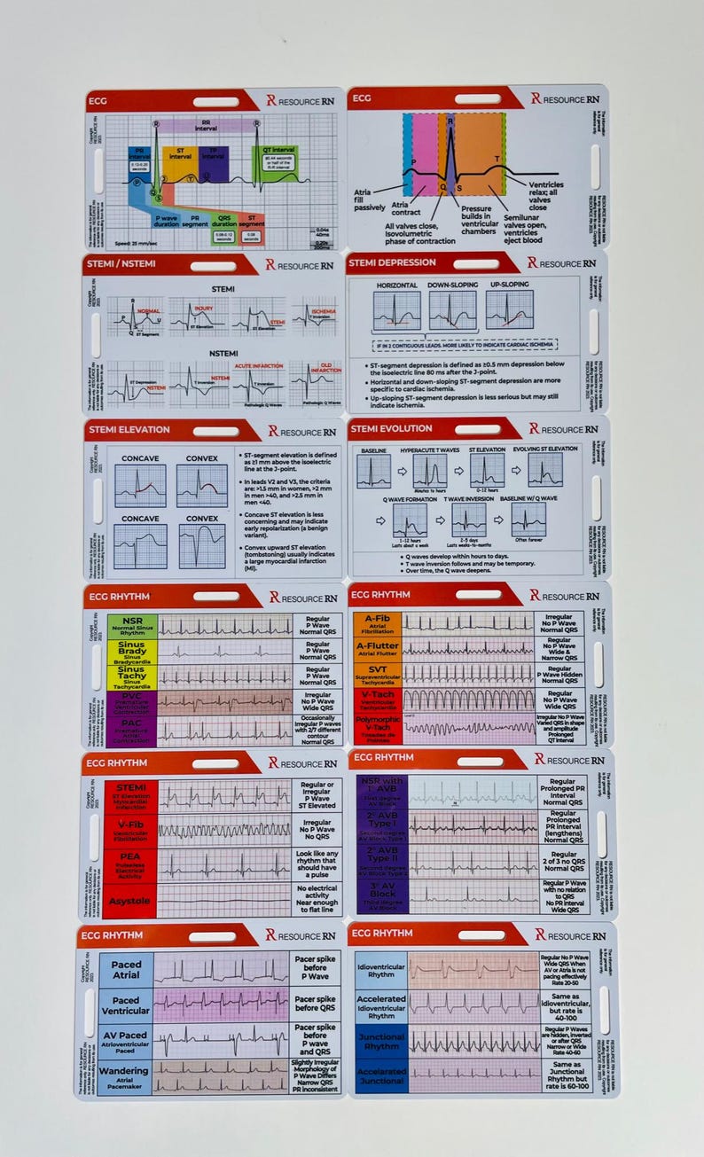 EKG Rhythm Analysis Nurse Badge Cards: STEMI, NSTEMI - 6-card Set - Etsy