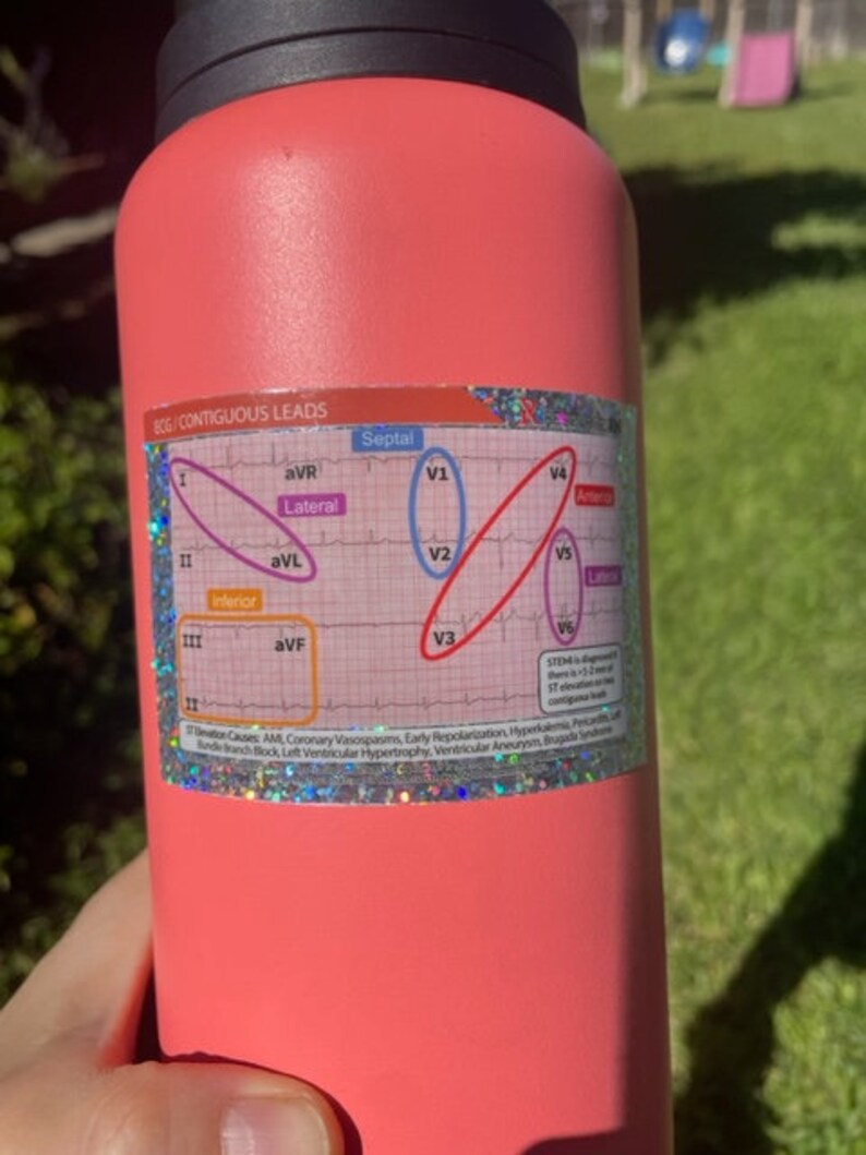 Glitter Sticker EKG STEMI Reference Tool RN Card - Etsy