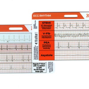 EKG Rhythm, STEMI, NSTEMI Analysis Reference Cards—6-card Set for Rapid ...