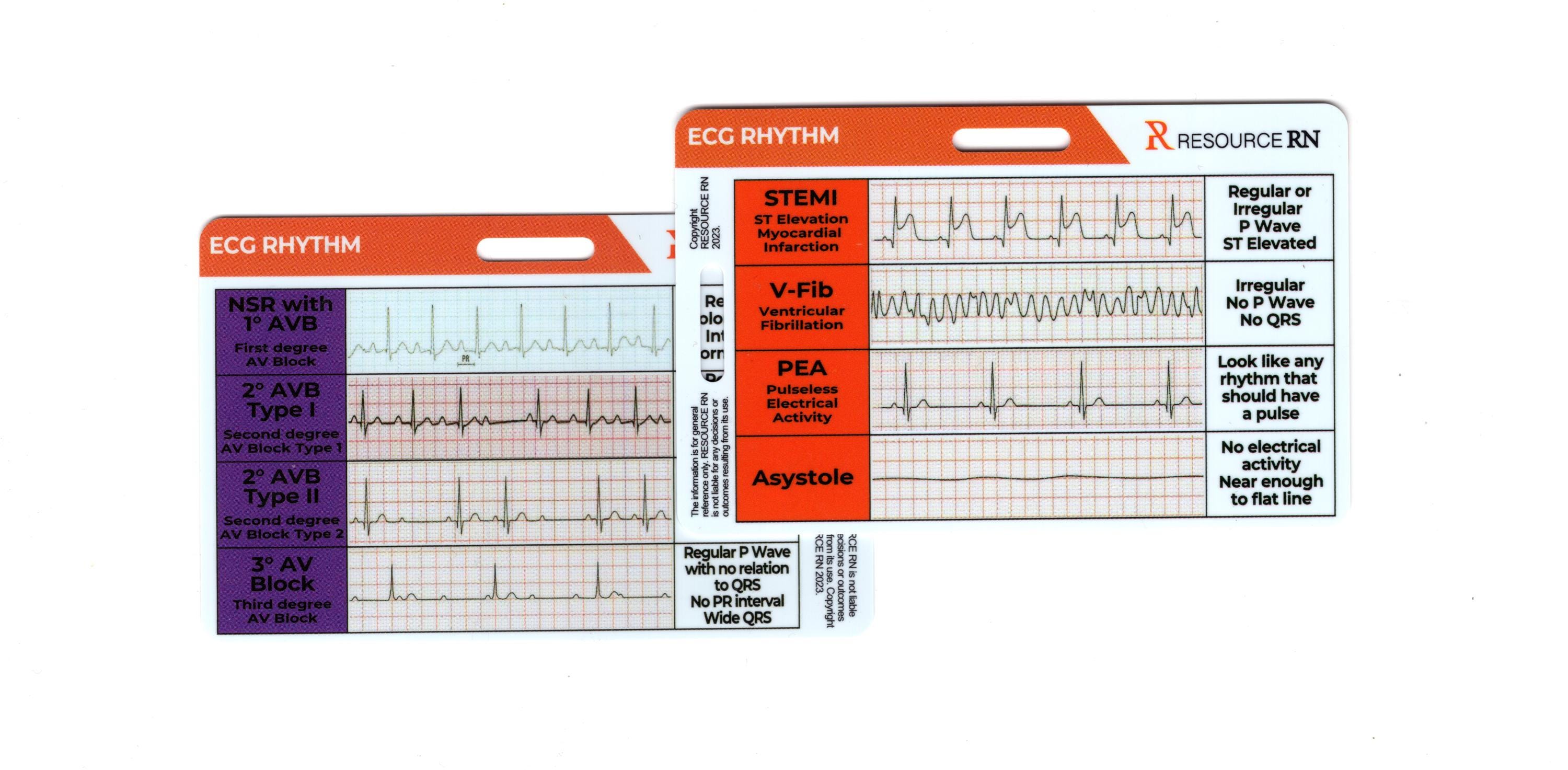 EKG Rhythm Analysis Nurse Badge Cards: STEMI, NSTEMI - 6-card Set - Etsy