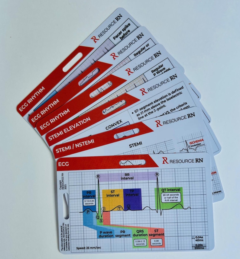 EKG Rhythm Analysis Nurse Badge Cards: STEMI, NSTEMI - 6-card Set - Etsy