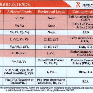 EKG STEMI Reference Tool VERTICAL Badge Card Pocket Guide - Etsy