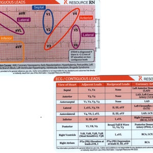 EKG STEMI Reference Tool VERTICAL Badge Card Pocket Guide - Etsy