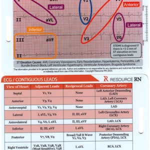 EKG STEMI Reference Tool VERTICAL Badge Card Pocket Guide - Etsy