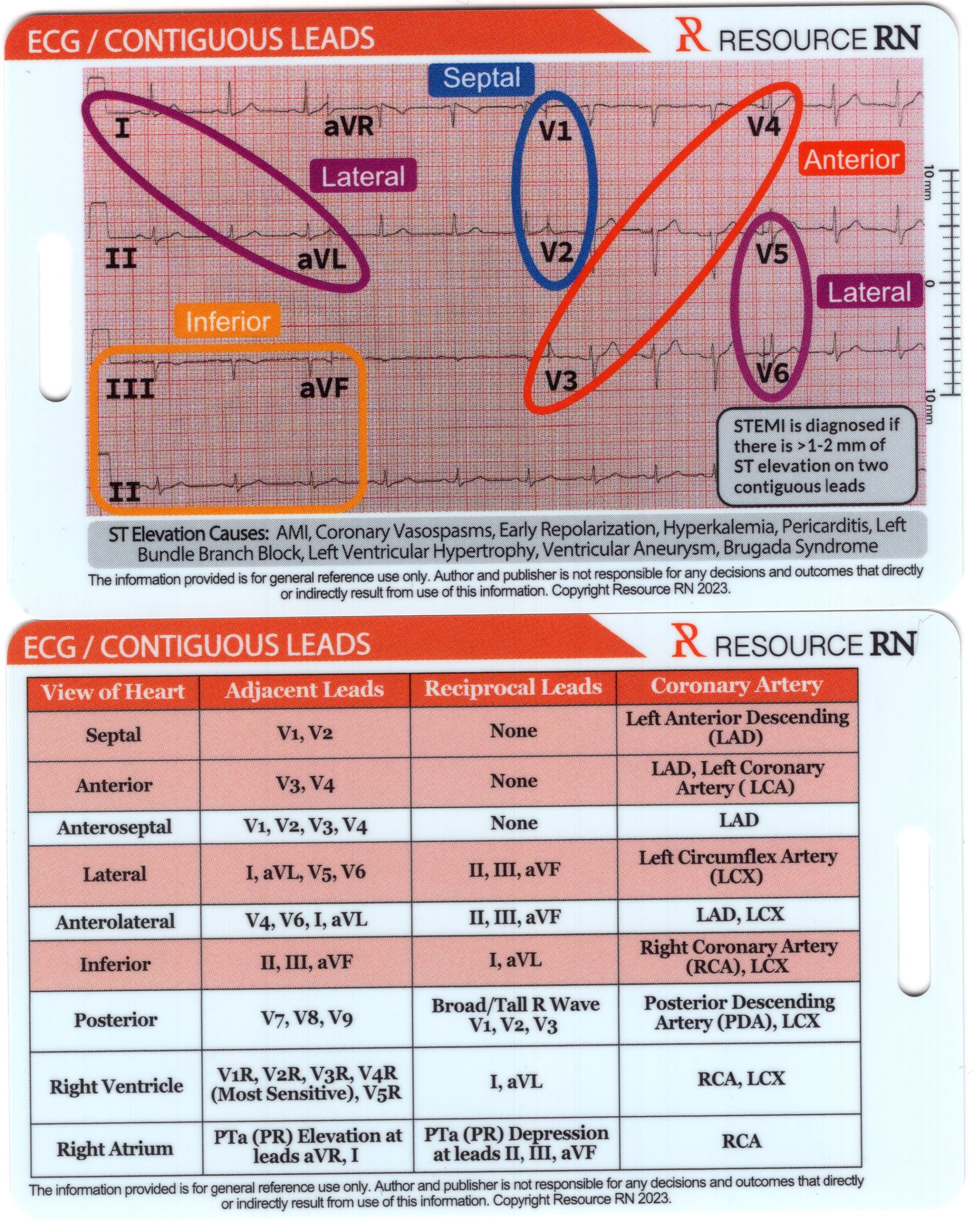 EKG STEMI Reference Tool VERTICAL Badge Card Pocket Guide - Etsy