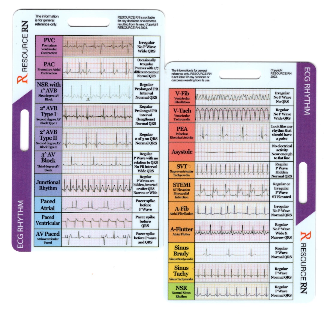 ECG/EKG Rhythms - Horizontal and Vertical Option, Healthcare, Nursing ...
