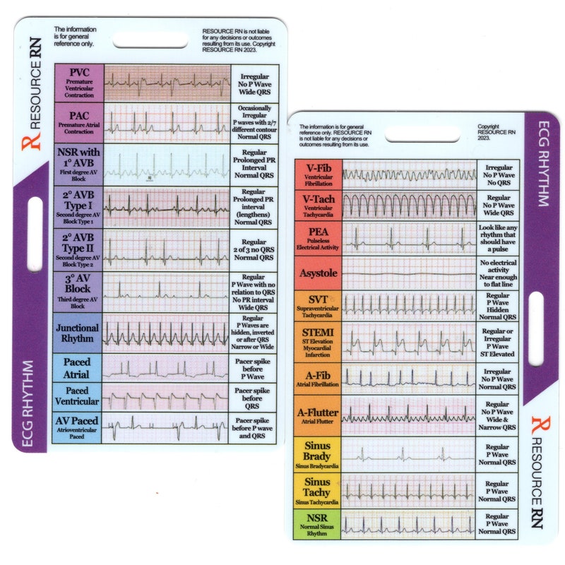 Ekg Cheat Sheet - Etsy