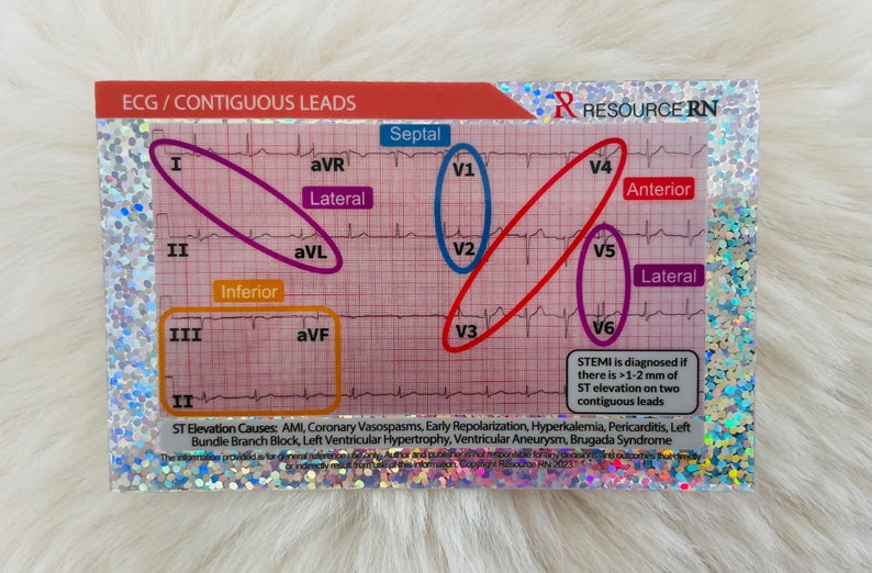 Glitter Sticker EKG STEMI Reference Tool RN Card - Etsy