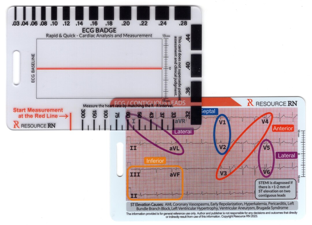 EKG Rapid Cardiac Measurement & STEMI Analysis Badge Cards – Vertical 2 ...