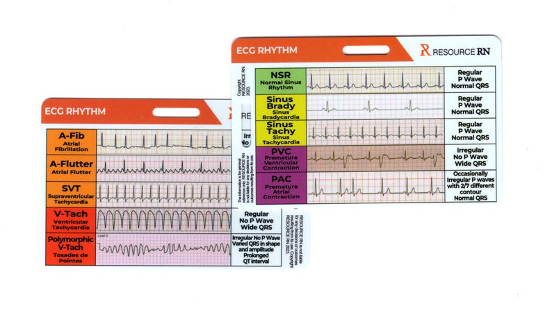 EKG Rhythm Analysis Nurse Badge Cards: STEMI, NSTEMI - 6-card Set - Etsy