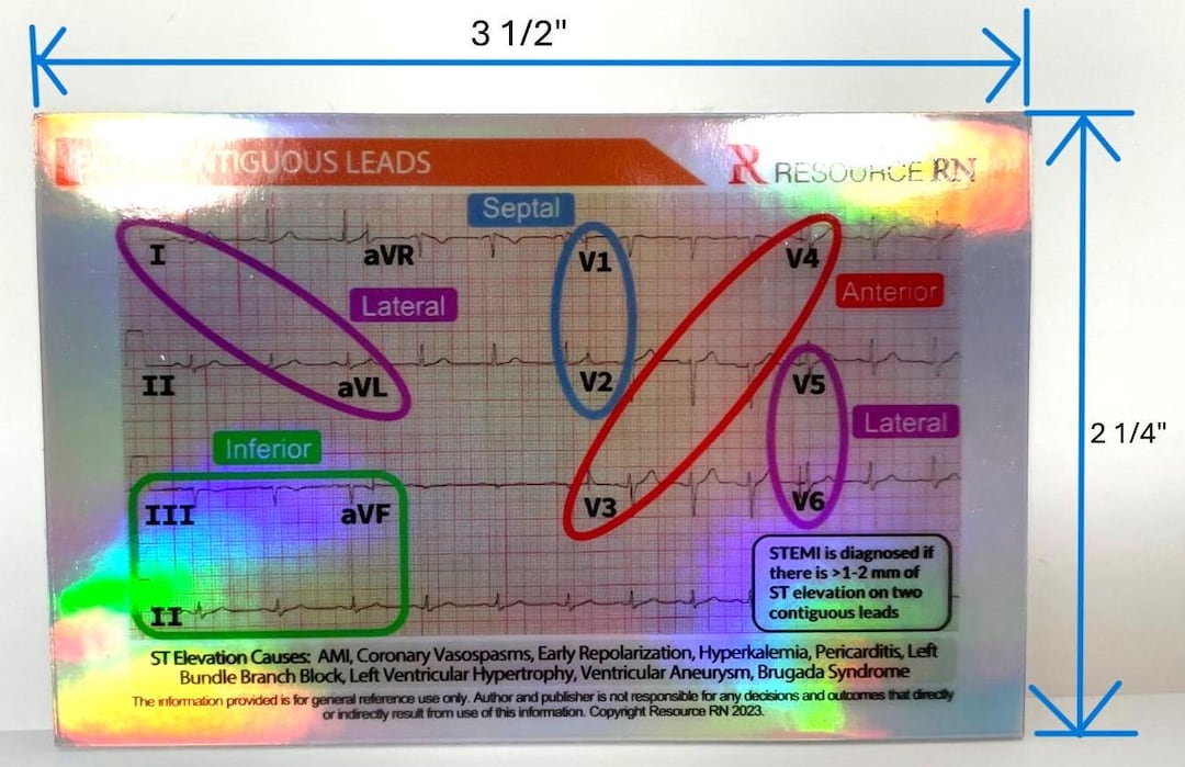 Holographic Sticker - EKG STEMI Reference Tool Badge Card - Etsy