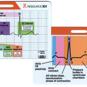 EKG Rhythm Analysis Nurse Badge Cards: STEMI, NSTEMI - 6-card Set - Etsy UK
