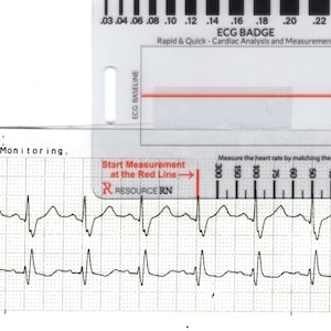 Rapid and Quick Cardiac Analysis and Measurement Tool Clear ECG Badge ...