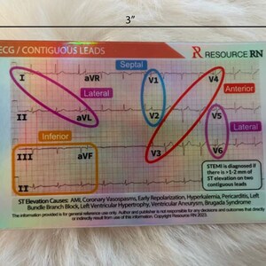 Holographic Sticker EKG STEMI Reference Tool Badge Card - Etsy