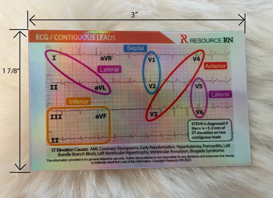Holographic Sticker EKG STEMI Reference Tool Badge Card - Etsy