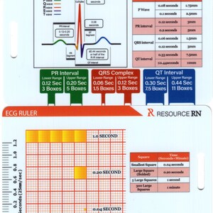 Cardiac Nursing Badge Card Set: ECG Interpretation & STEMI Tool - Etsy