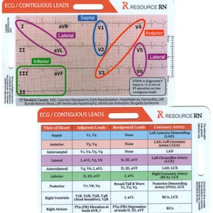 EKG STEMI Reference Tool - Horizontal and Vertical Badge Card Pocket ...