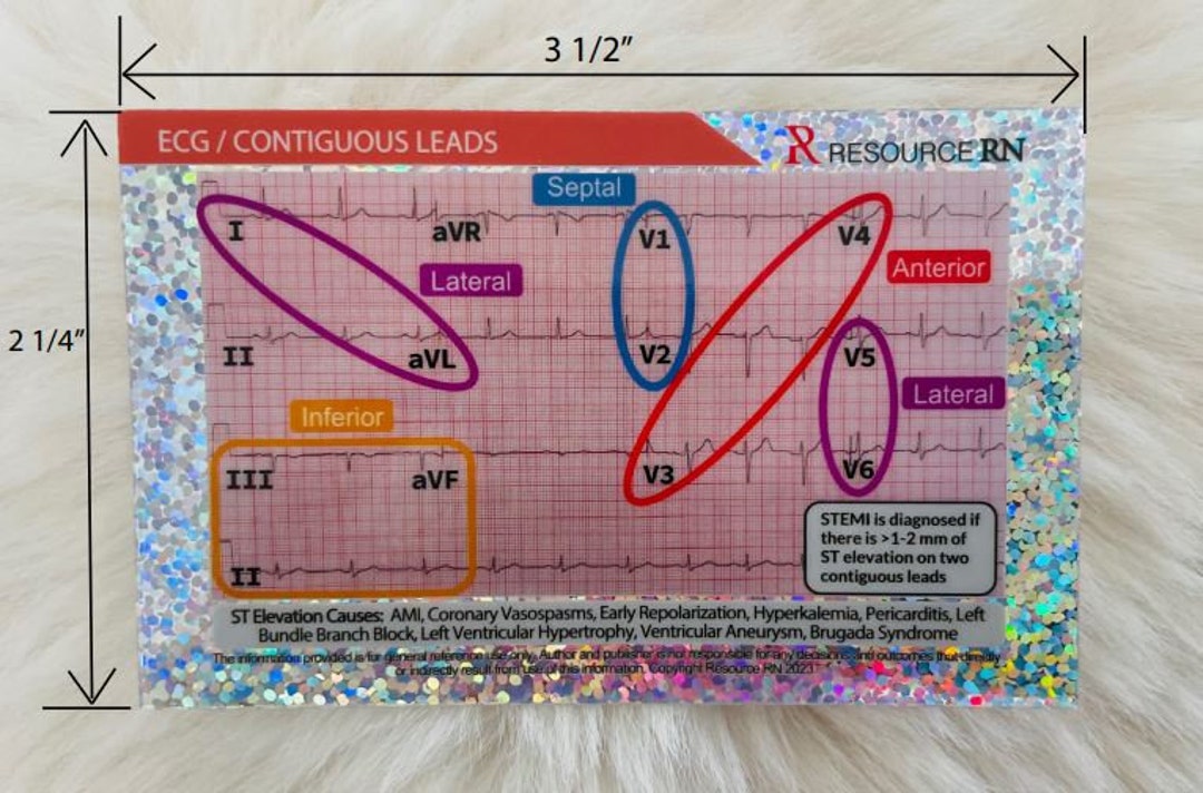 Glitter Sticker EKG STEMI Reference Tool RN Card - Etsy