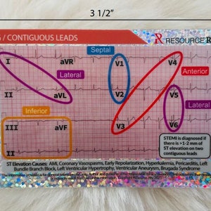 Glitter Sticker EKG STEMI Reference Tool RN Card - Etsy