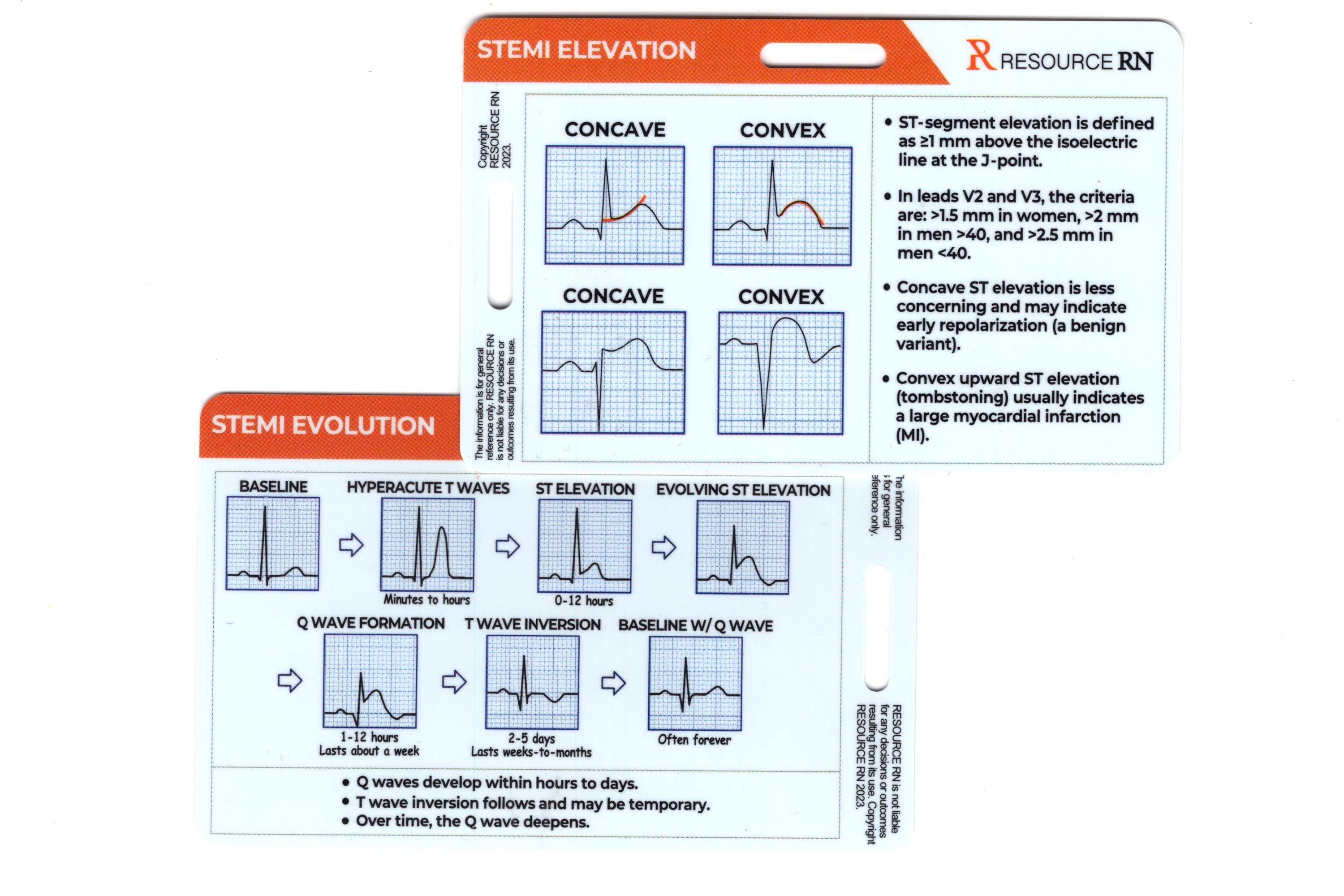 EKG Rhythm Analysis Nurse Badge Cards: STEMI, NSTEMI - 6-card Set - Etsy