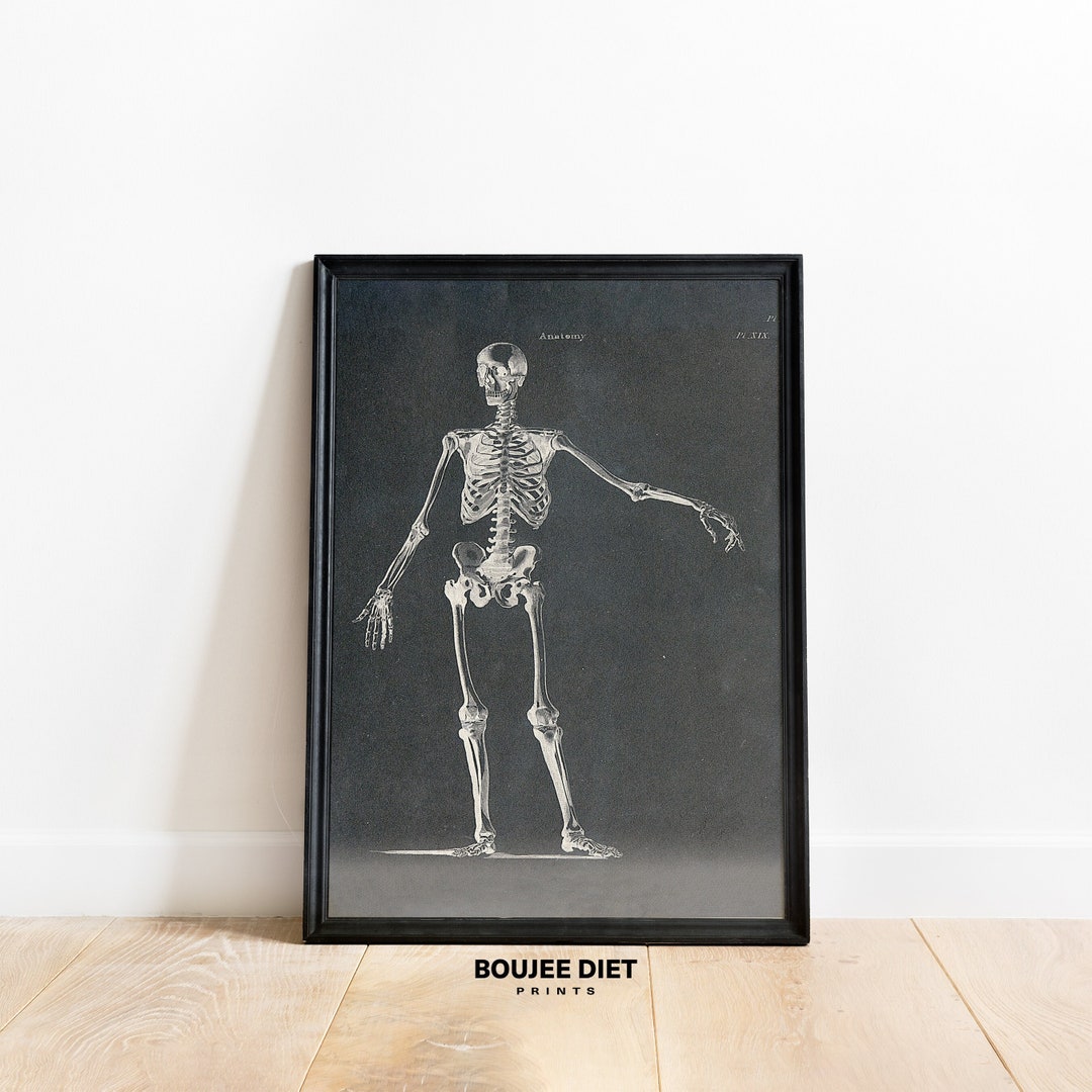 X-ray Skeleton Art Print Halloween Wall Art Printable Posing Skeleton ...