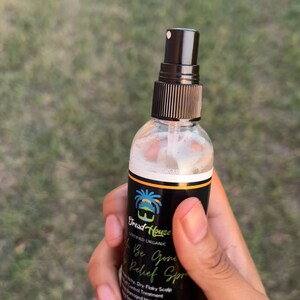 Itchy Dreadlocks Scalp Loc Spray Hydration Mist Loc Mist Spray ANTI ...