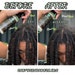 Itchy Dreadlocks Scalp Loc Spray Hydration Mist Loc Mist Spray ANTI ...