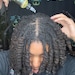 Itchy Scalp Oil Scalp Care Itchy Hair Dreadlocks Locs Twists Braids ...
