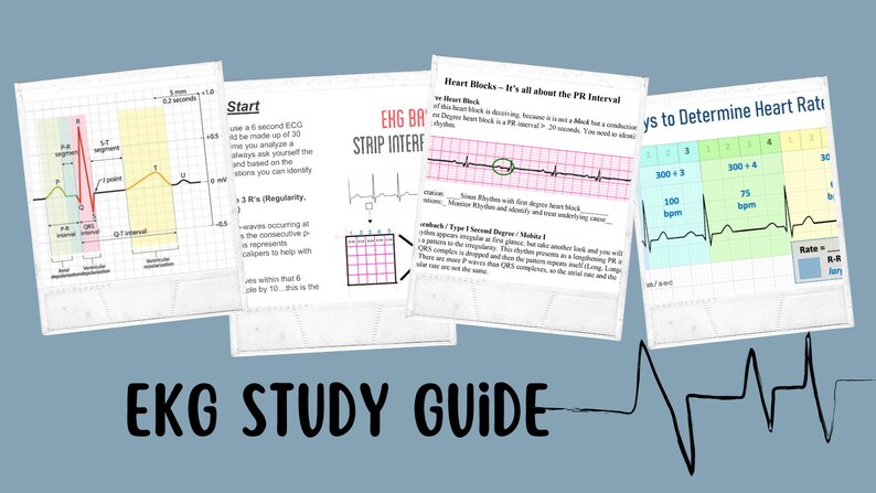 EKG Study Guide - Etsy