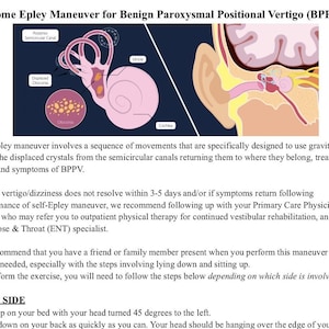 Epley Maneuver Patient Handout for BPPV - Etsy