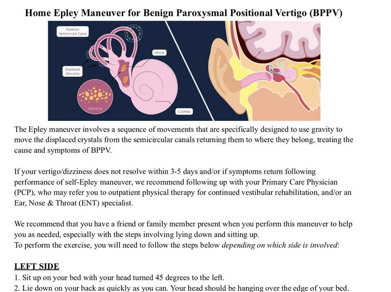 Epley Maneuver Patient Handout for BPPV - Etsy