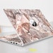 Hp Victus Laptop Skin Personalized Customizable Abstract Texture Vinyl ...