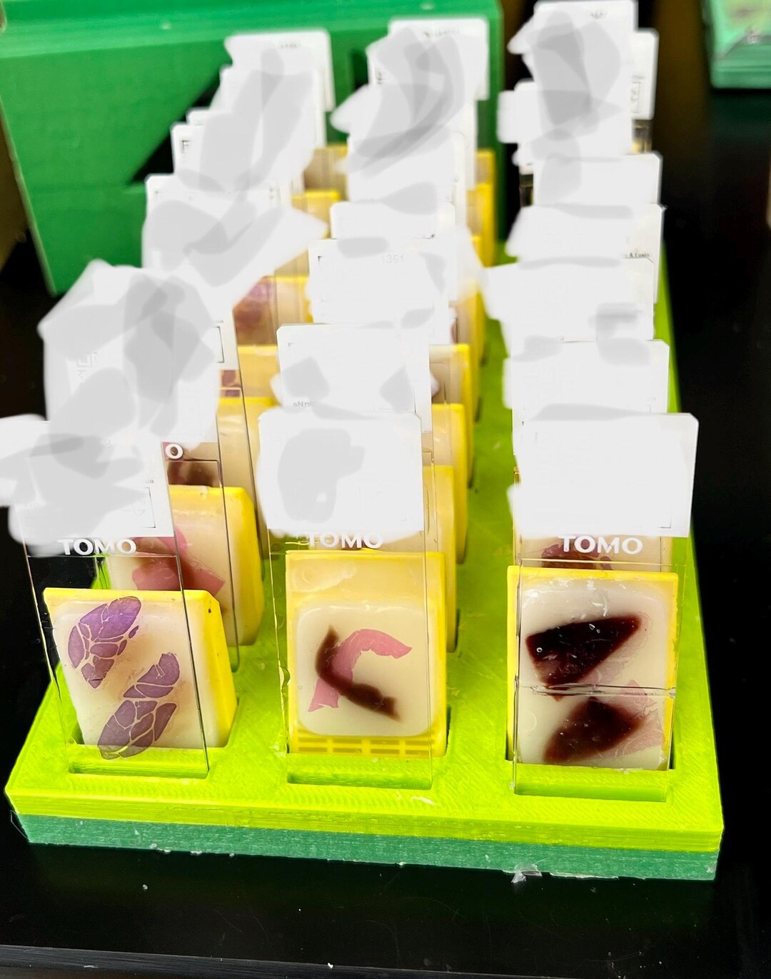 Histology QC Slide-to-block Matching Tray – 24-slot Holder for Gross ...