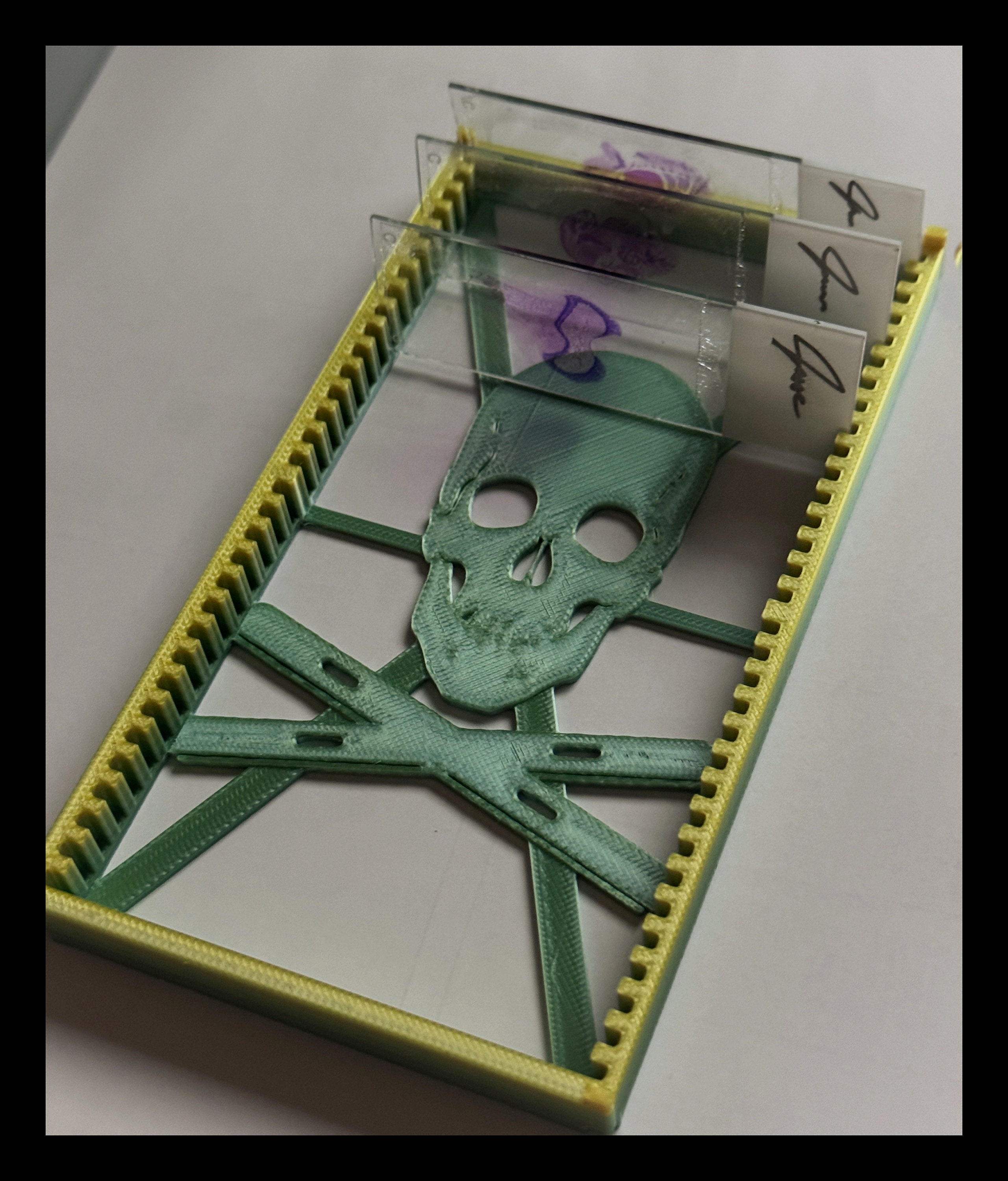 3D Printed Custom Histology Laboratory Slide Rack: an Innovative ...