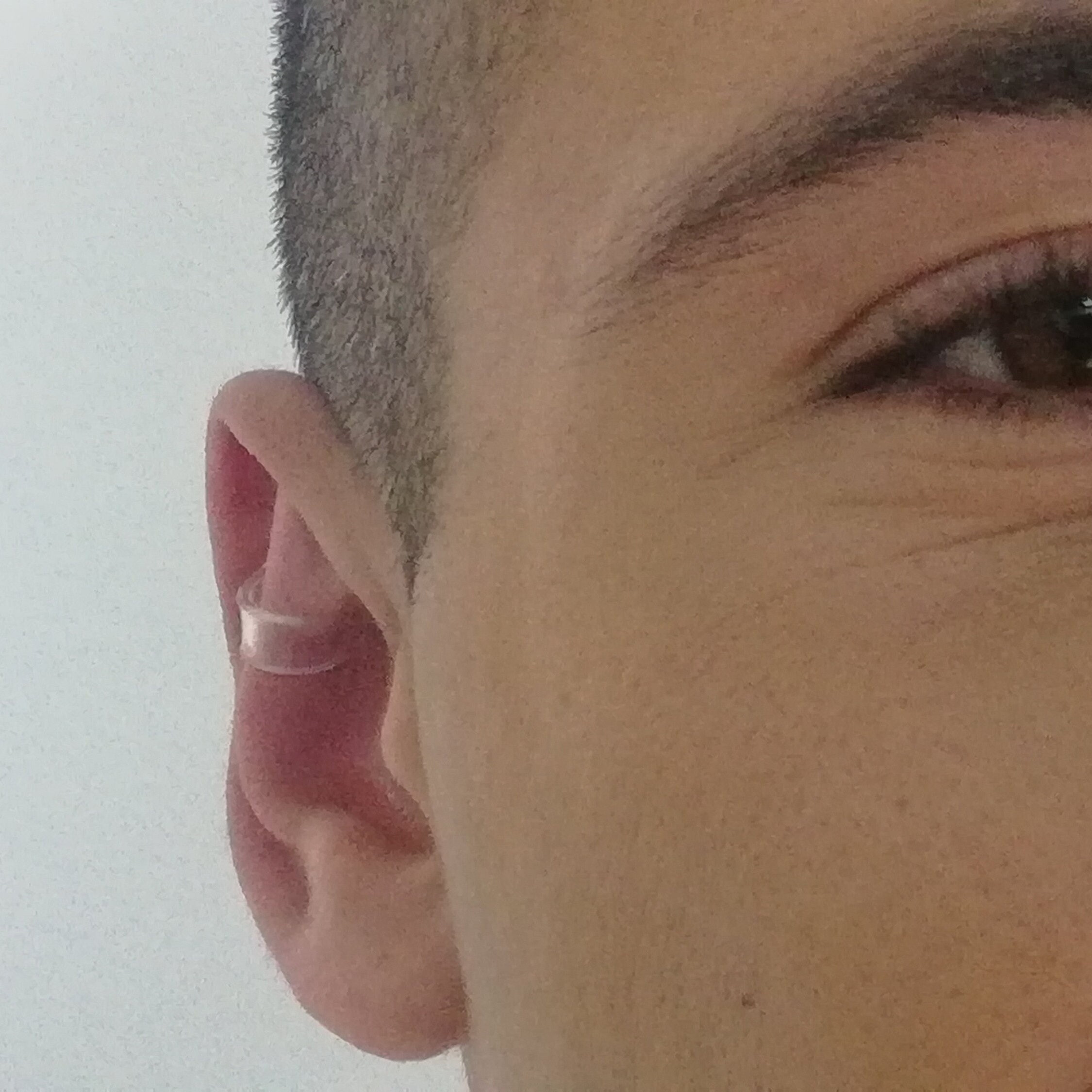 Aesthetic Correctors for Protruding Ears - Etsy