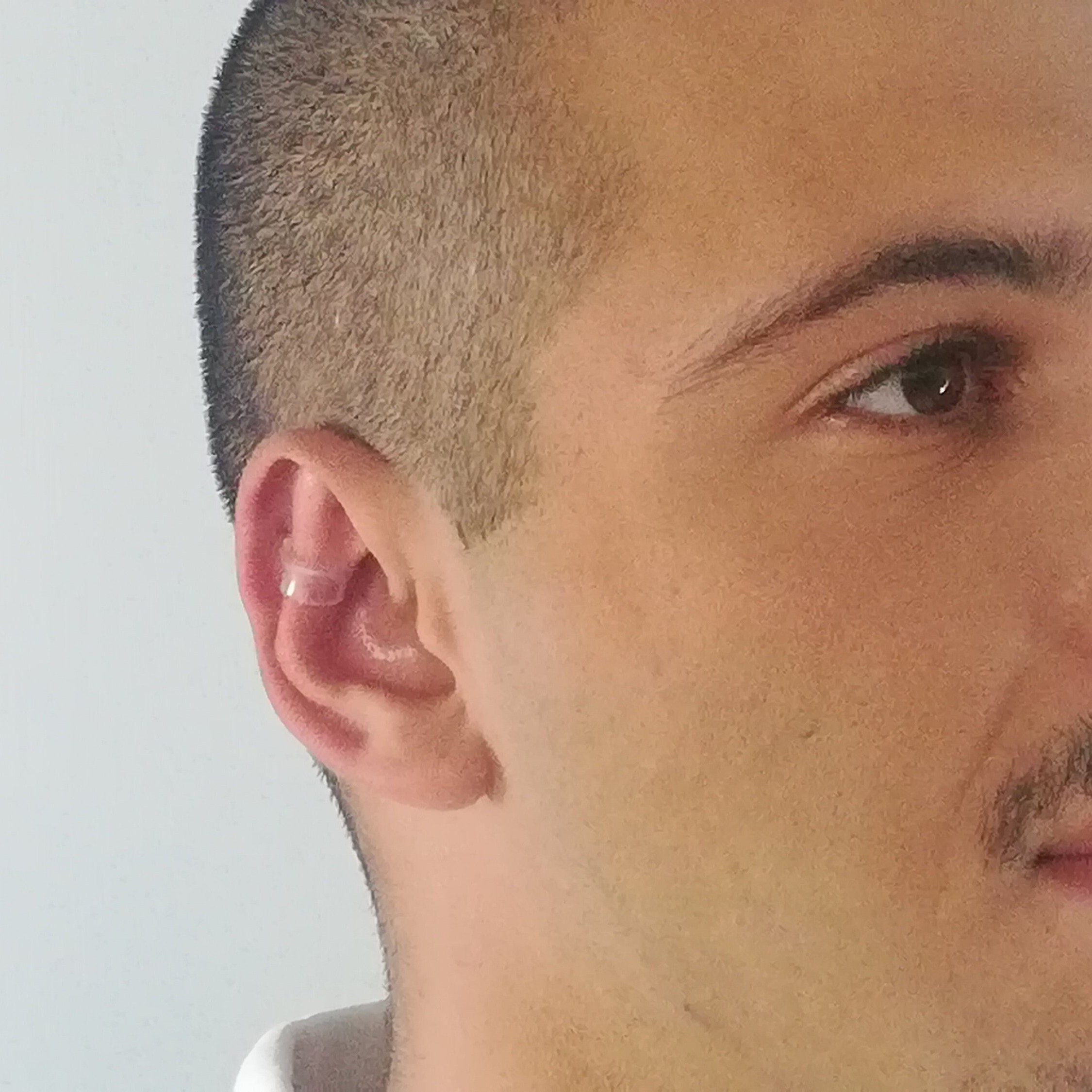 Aesthetic Correctors for Protruding Ears - Etsy