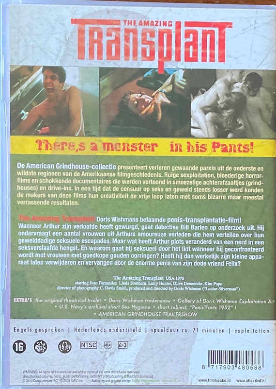 The Amazing Transplant