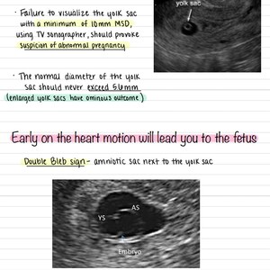 Unit 3: First Trimester OB Sonography - Etsy